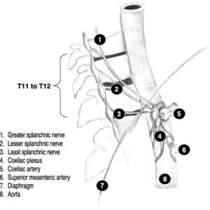 Fluoroscopic Guided Celiac Plexus/Splanchnic Nerve Block - Technique and Overview - The ...