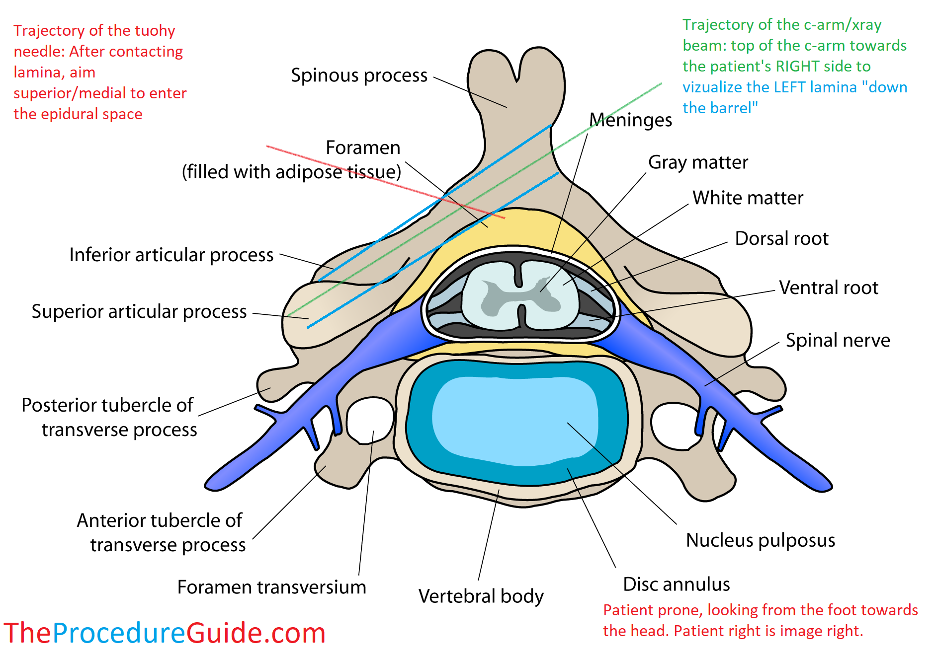 Ventral Epidural Space